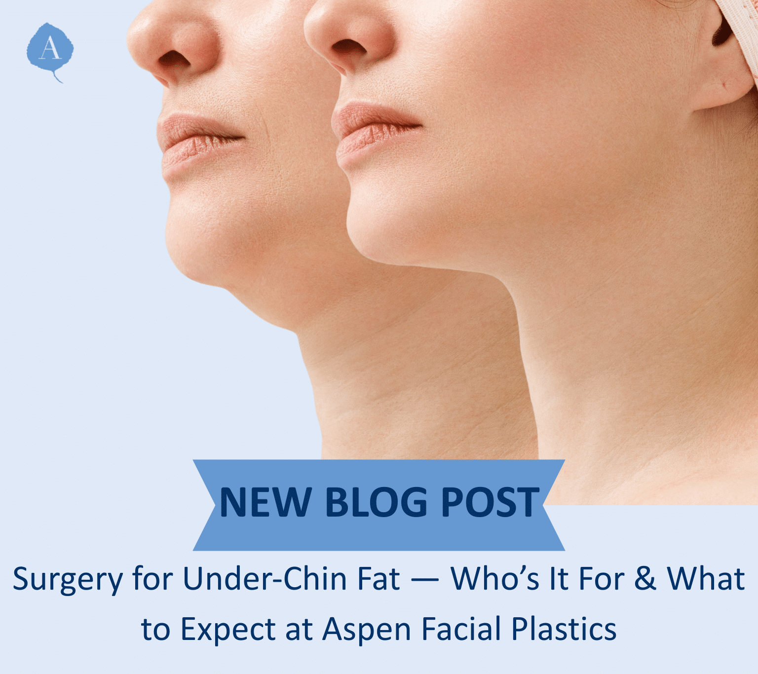 Surgery for Fat Under Chin | Aspen Facial Plastics | Submental ...